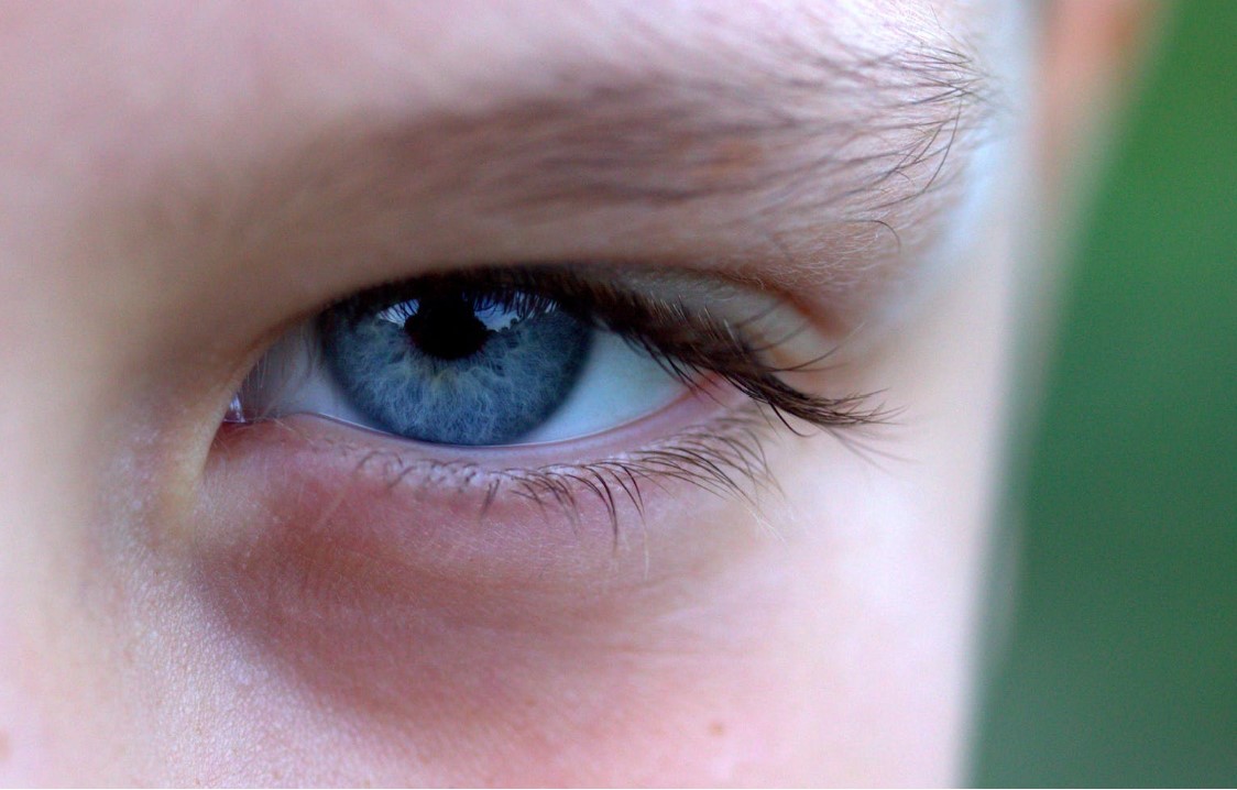 AI Achieves 100% Accuracy in Diagnosing Childhood Autism from Eye Photos